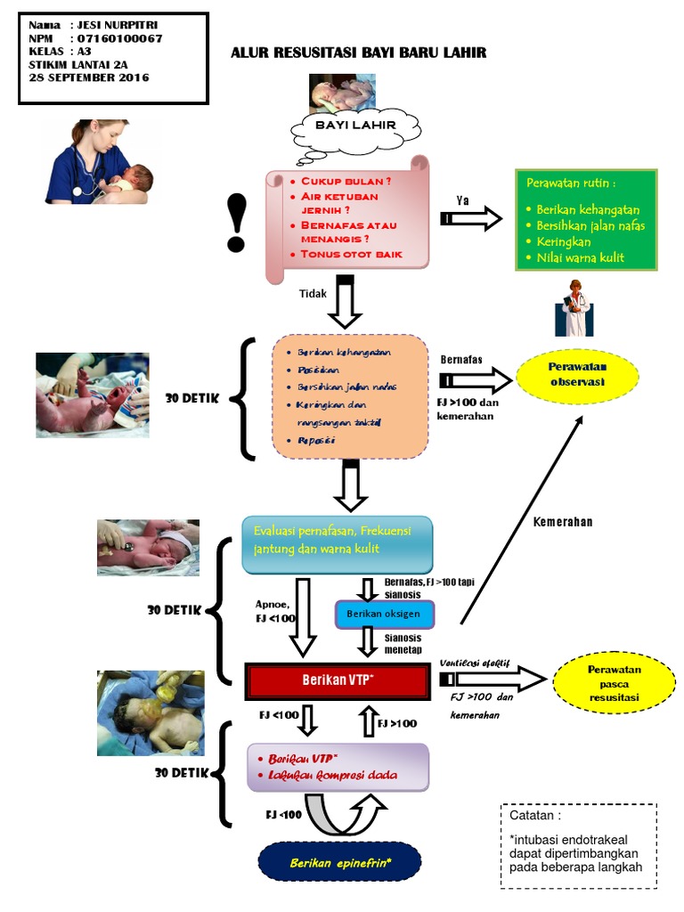Alur Resusitasi Bayi Baru Lahir Jesi Nurfitri