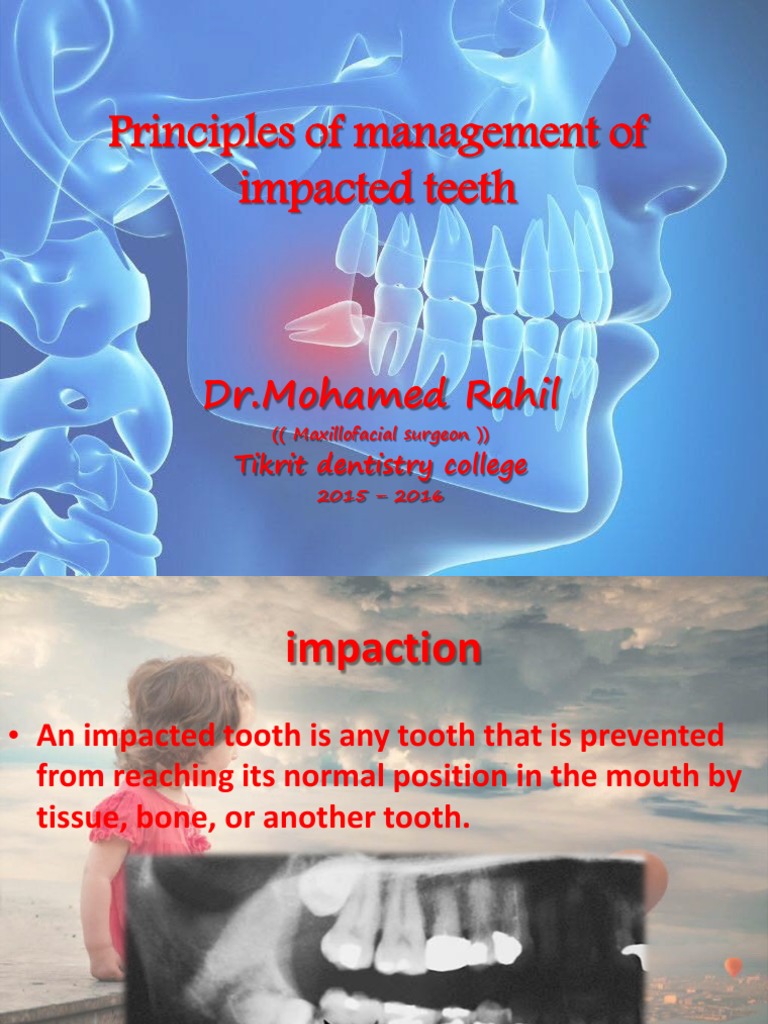 Principles of Management of Impacted Teeth: A Guide to Surgical ...