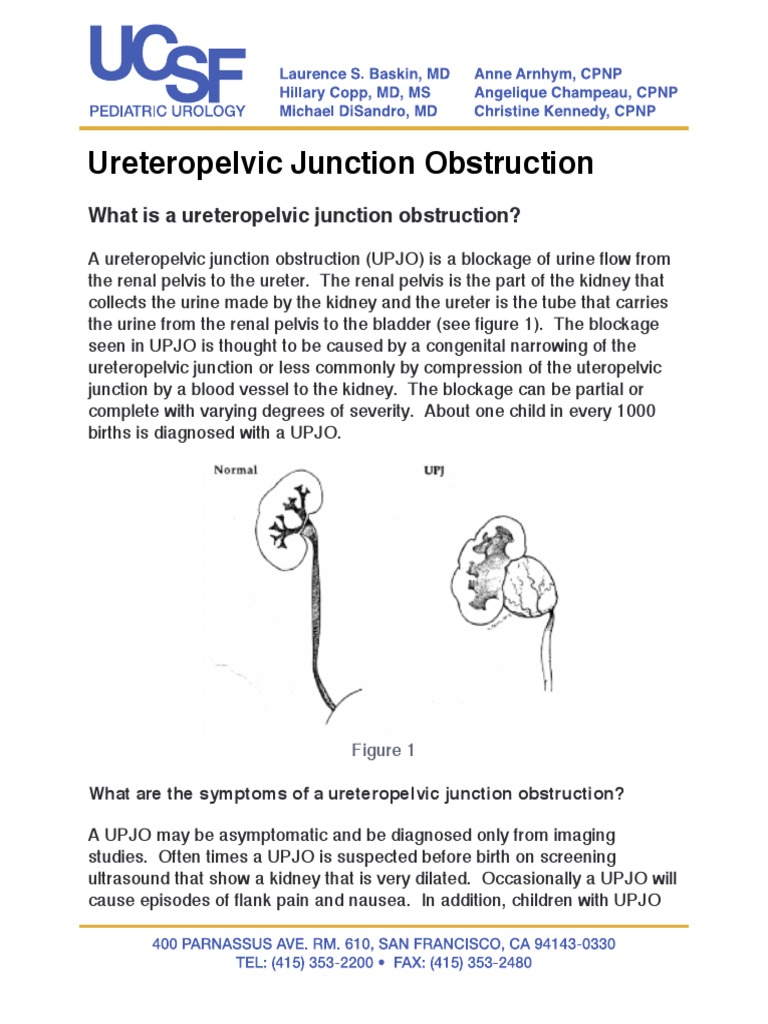 Ureteropelvic Junction Obstruction Overview | PDF | Genitourinary ...