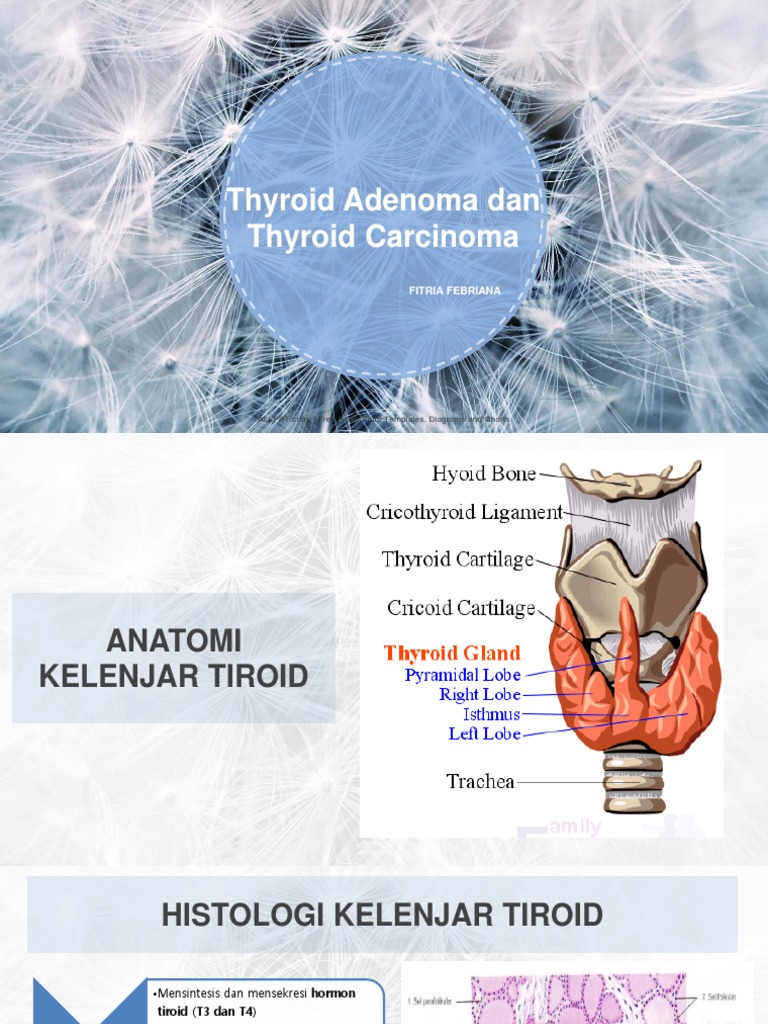 Adenoma Dan Karsinoma Tiroid | PDF