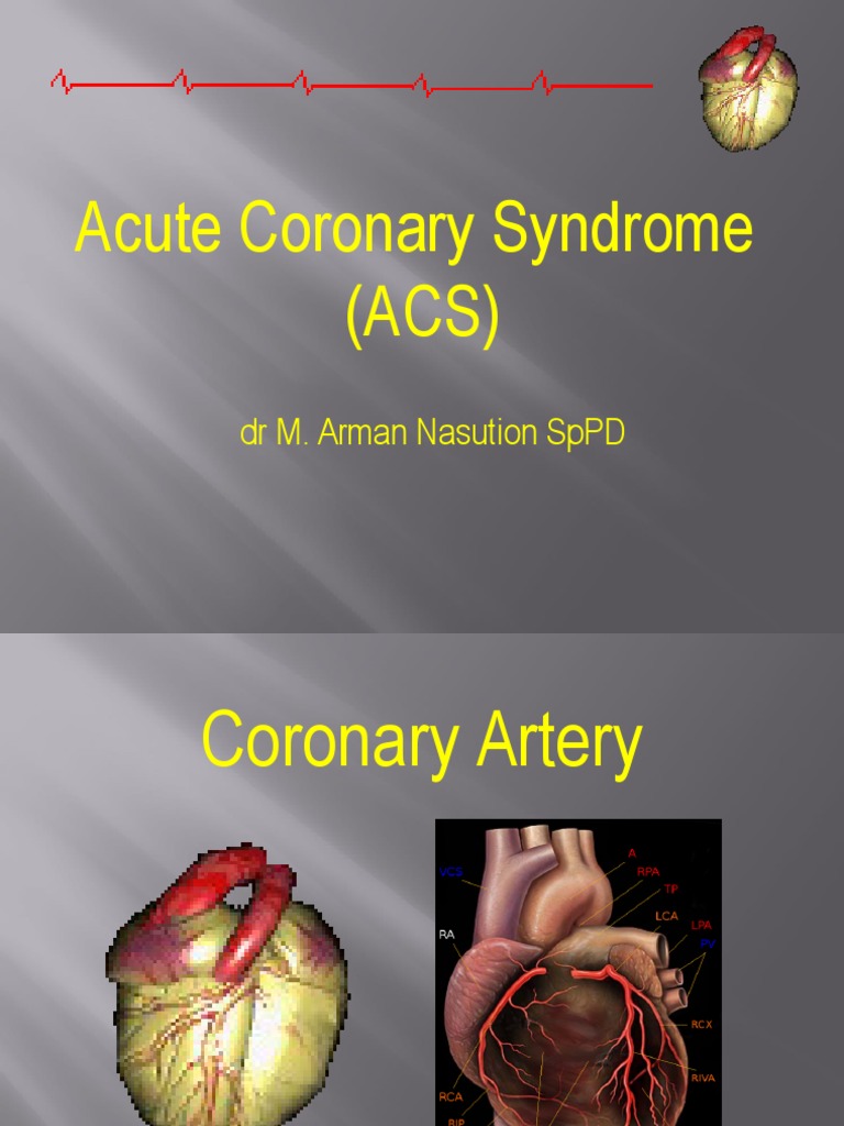 Acute Coronary Syndrome (Acs): Dr M. Arman Nasution Sppd