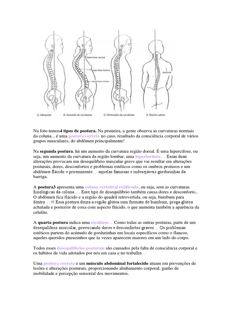 Coluna Vertebral Plana