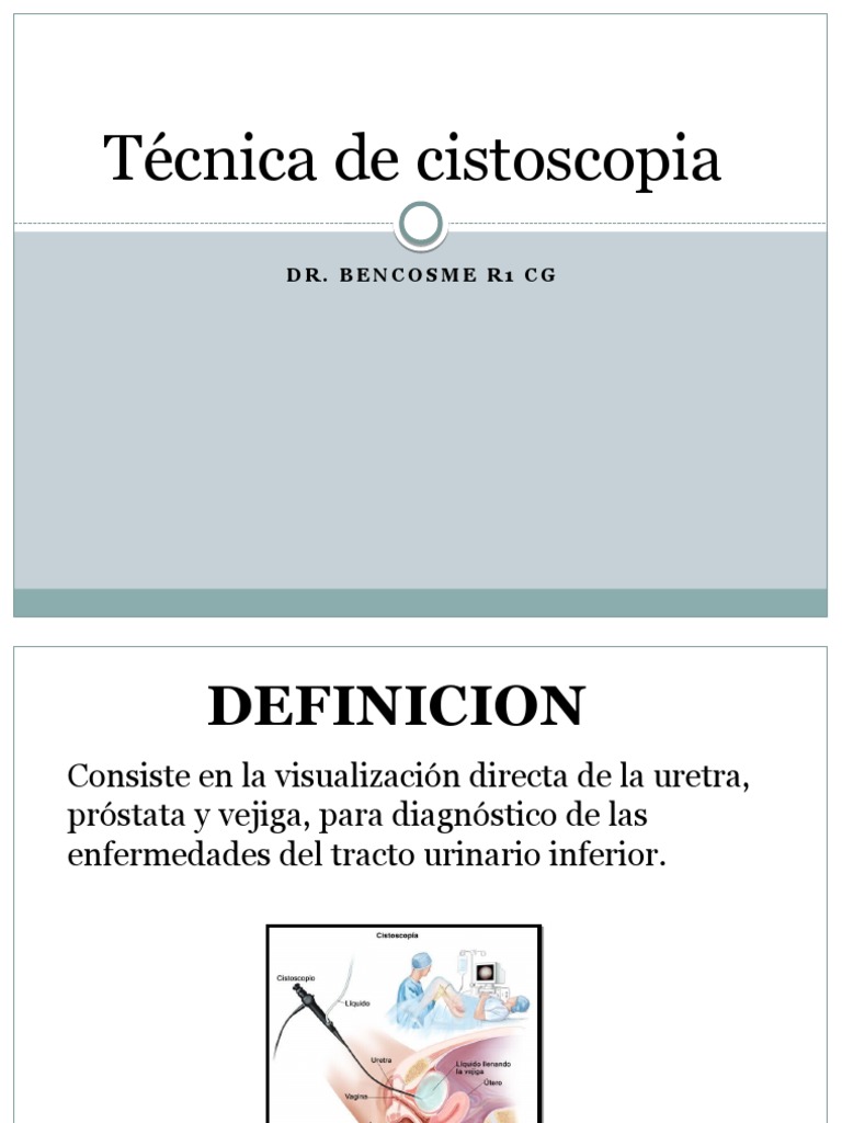 Tecnica de Cistoscopia | Vejiga urinaria | Especialidades Medicas