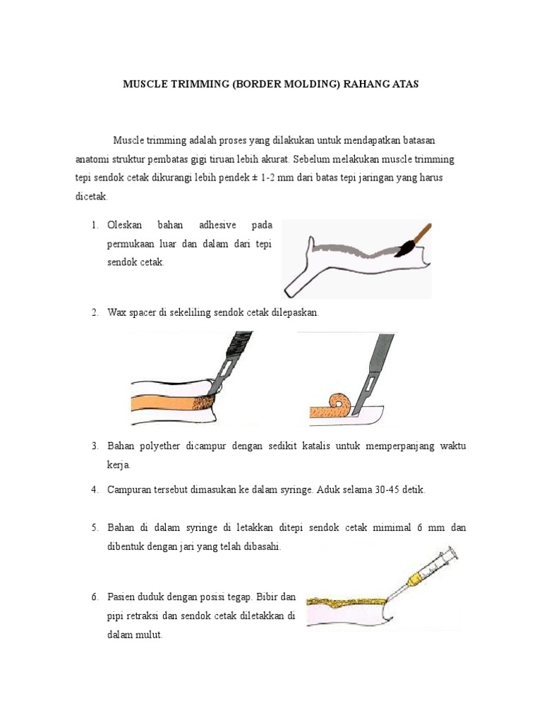 Muscle Trimming | PDF