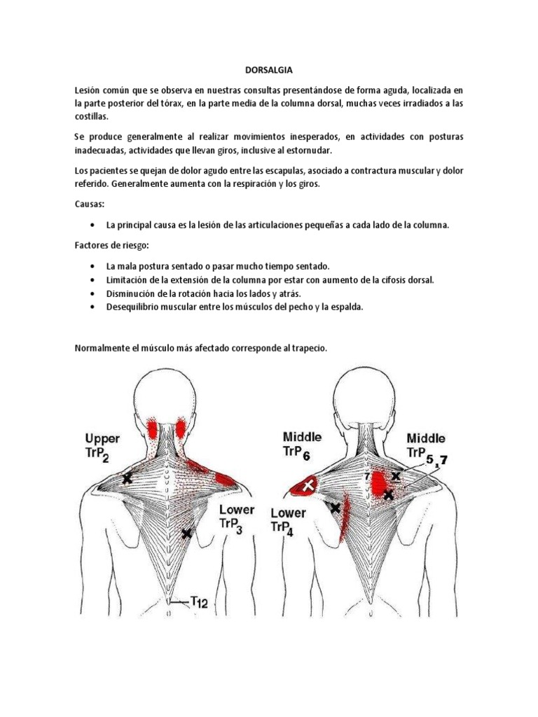 DORSALGIA.docx
