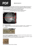 Pitch y TC Helicoidal | PDF | Ct Scan