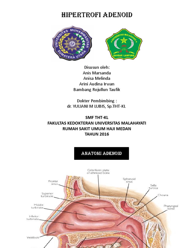 Adenoid Hipertrofi | PDF