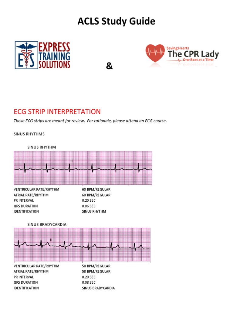 A Comprehensive Guide to ECG Interpretation and Application of ACLS ...