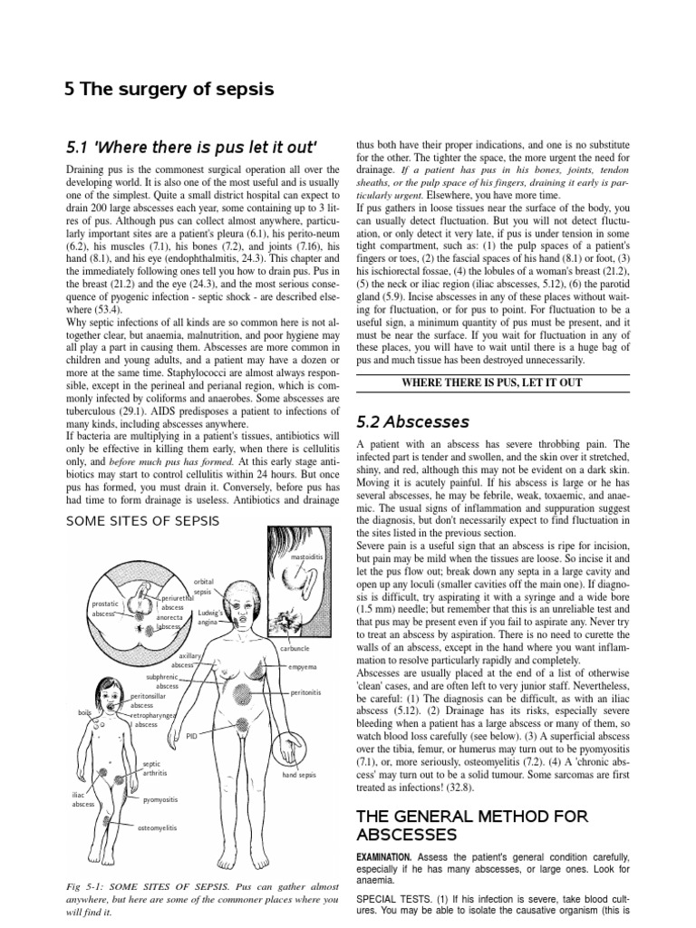 Primary Surgery - Abscess | Diseases And Disorders | Human Head And Neck