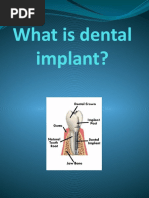 IMP Manual DS PrimeTaper Surgical Manual and Product Catalog 32671962 | PDF | Dental Implant ...