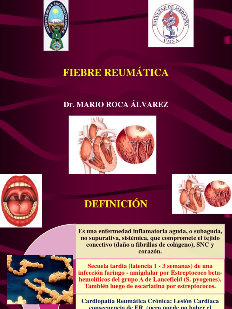 Fiebre Reumatica | RTT | Ciencias de la Salud