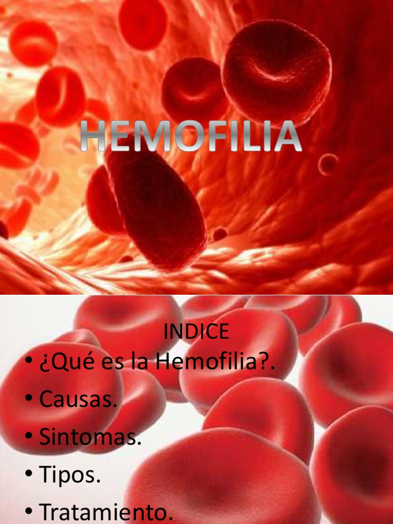 Hemofilia | PDF | Hemofilia | Medicina CLINICA
