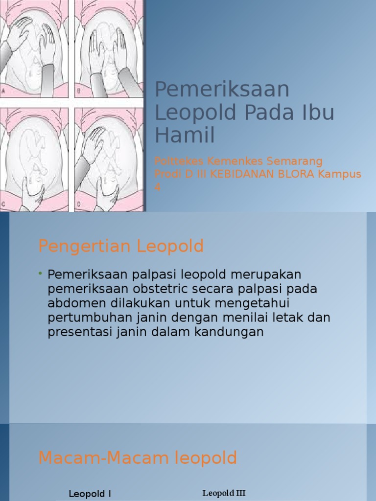 Pemeriksaan Leopold Pada Ibu Hamil | PDF