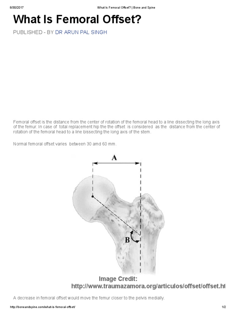What Is Femoral Offset - Bone and Spine | Download Free PDF | Hip | Pelvis