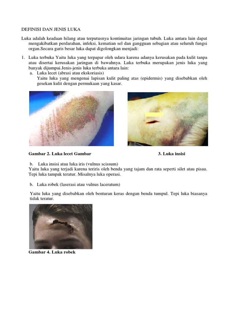 Definisi Dan Jenis Luka | PDF