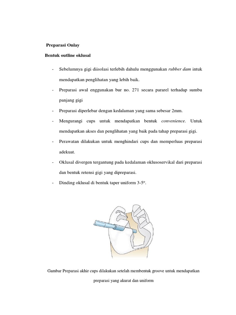 Preparasi ONLAY | PDF