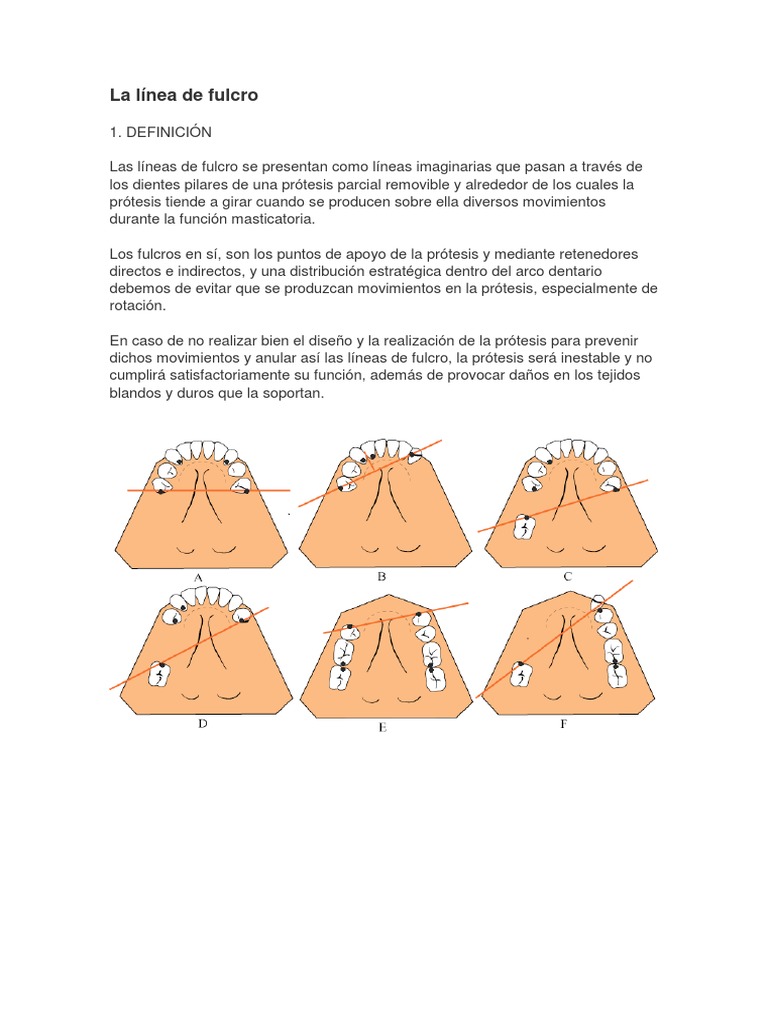 La Línea de Fulcro | PDF | Dentadura postiza | Naturaleza