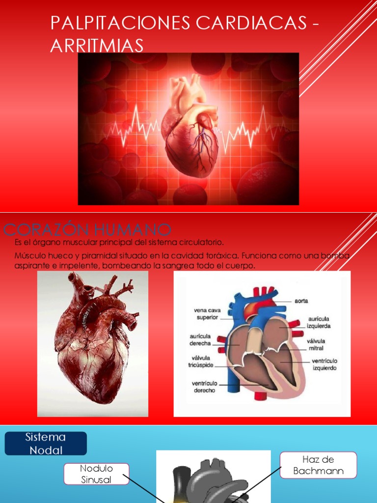 Palpitaciones Cardiacas - Arritmias | Descargar gratis PDF | Arritmia ...