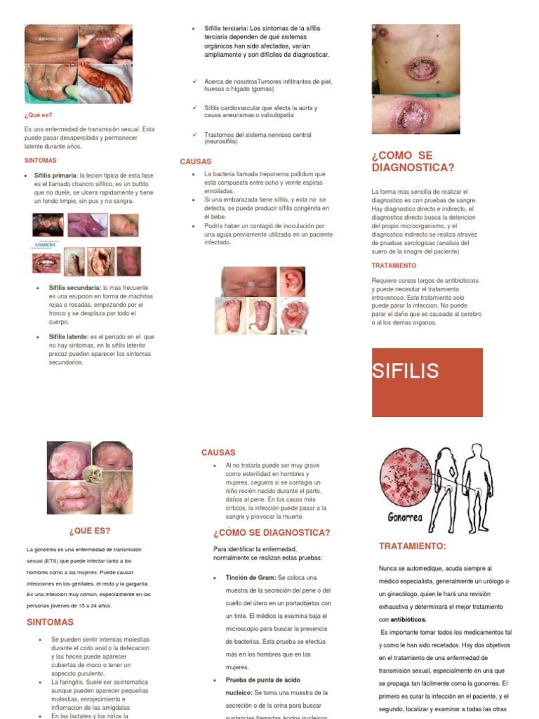 Folleto Sifilis | Infección transmitida sexualmente | Salud pública