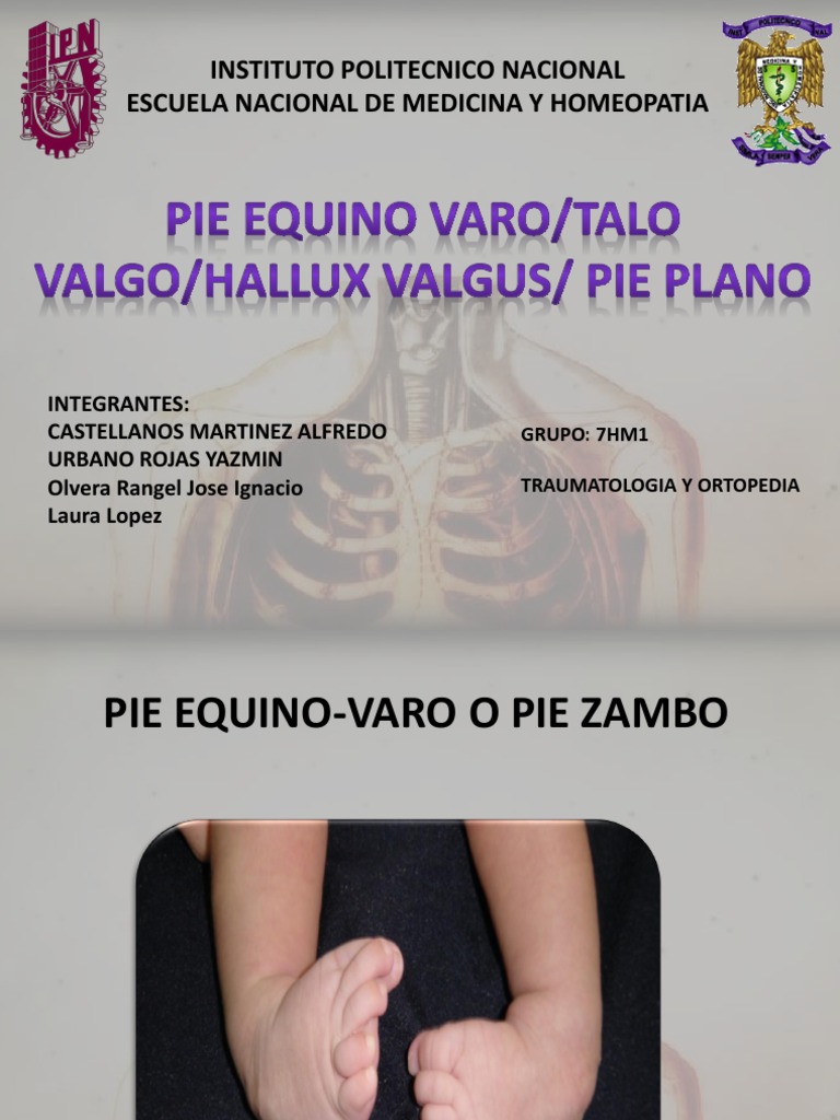 Pie Equino, Zambo, Pie Plano | Dedo del pie | Pie