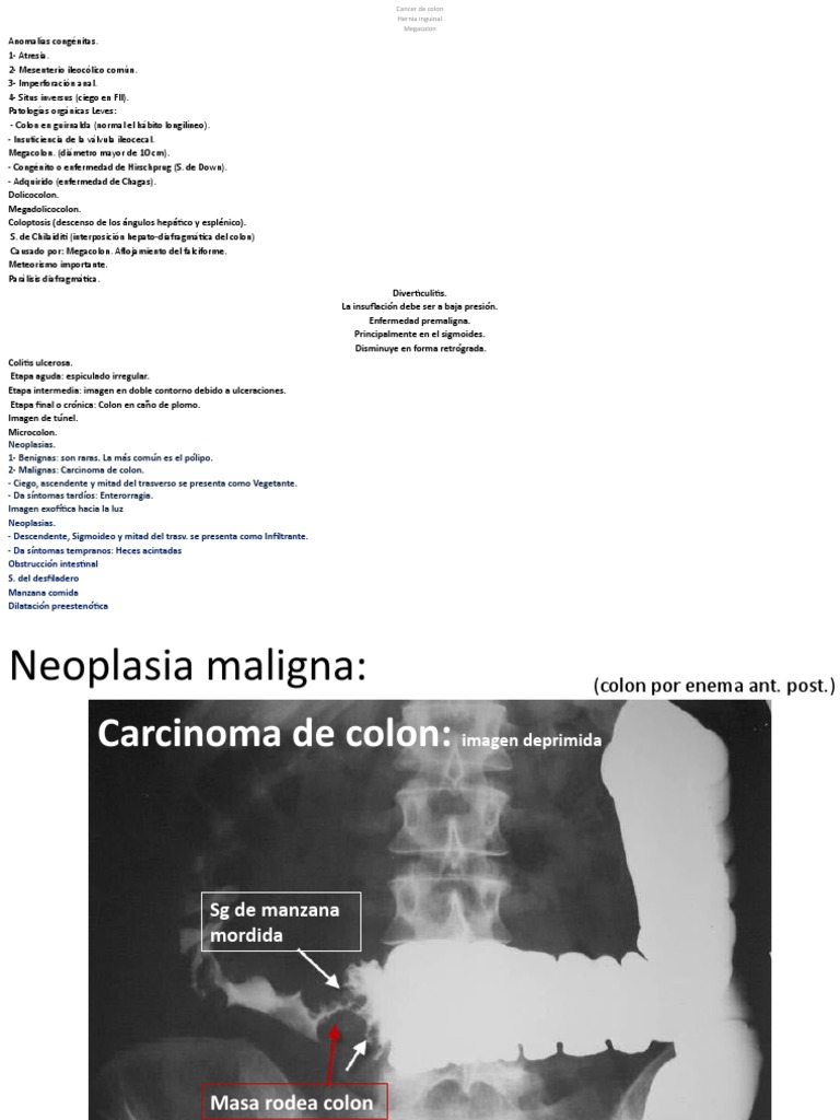 Radiologia - Colon | PDF | Cáncer colonrectal | Intestino grueso