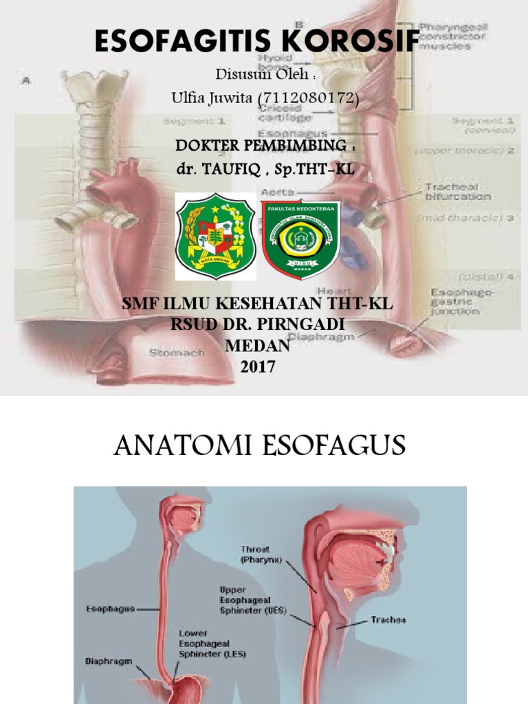 Esofagitis Korosif | PDF