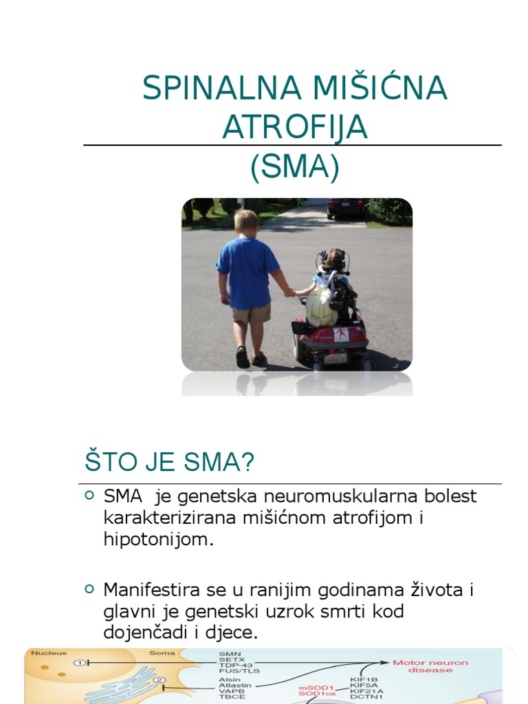 Spinalna Mišićna Atrofija | PDF