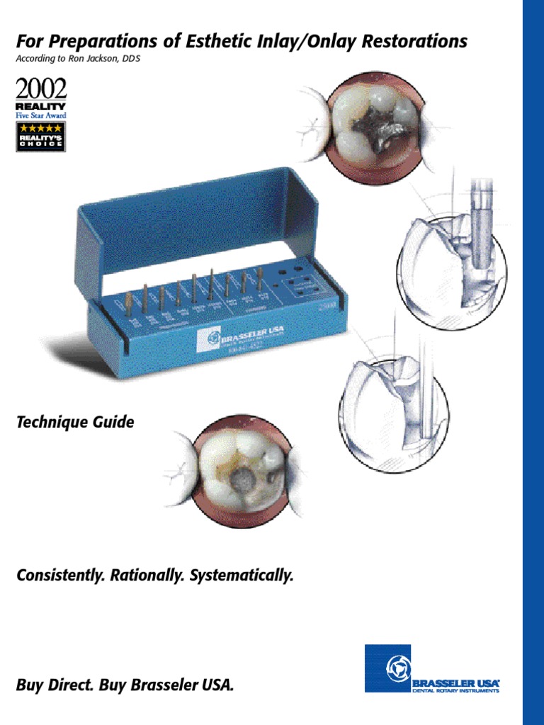 For Preparations of Esthetic Inlay/Onlay Restorations: Technique Guide ...