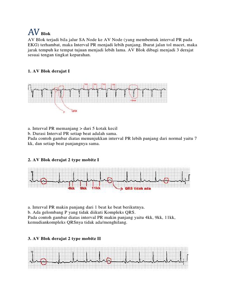AV Blok Scribd | PDF | Teknologi & Rekayasa