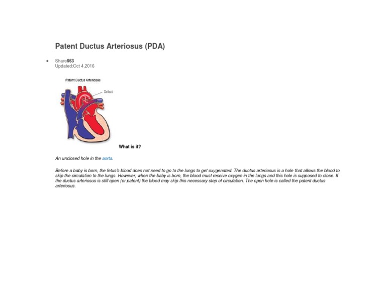 Patent Ductus Arteriosus | PDF