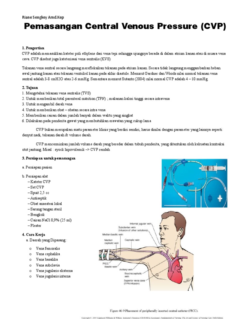 Pemasangan Central Venous Pressure (CVP) | PDF