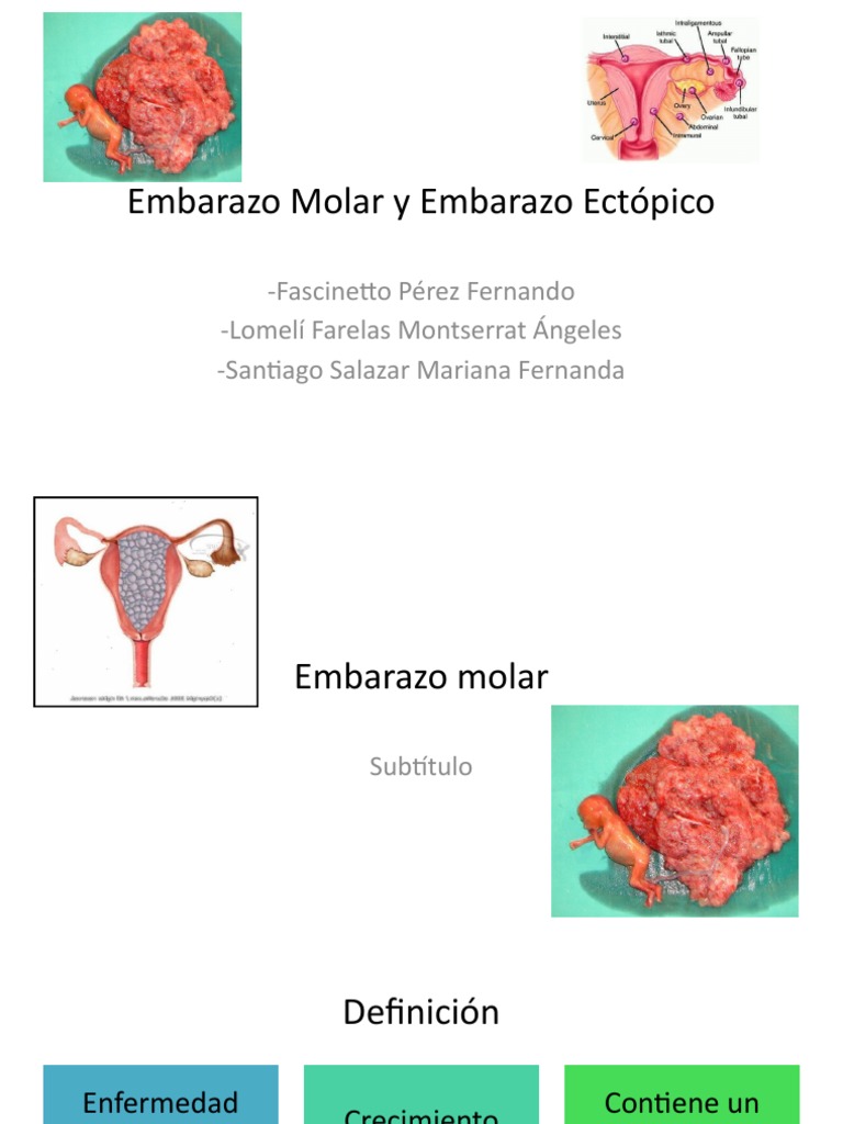 Embarazo-molar y Ectópico (Equipo7)