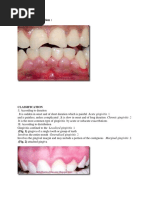 Teeth Eruption and Calcification Chart | PDF | Tooth | Human Head And Neck