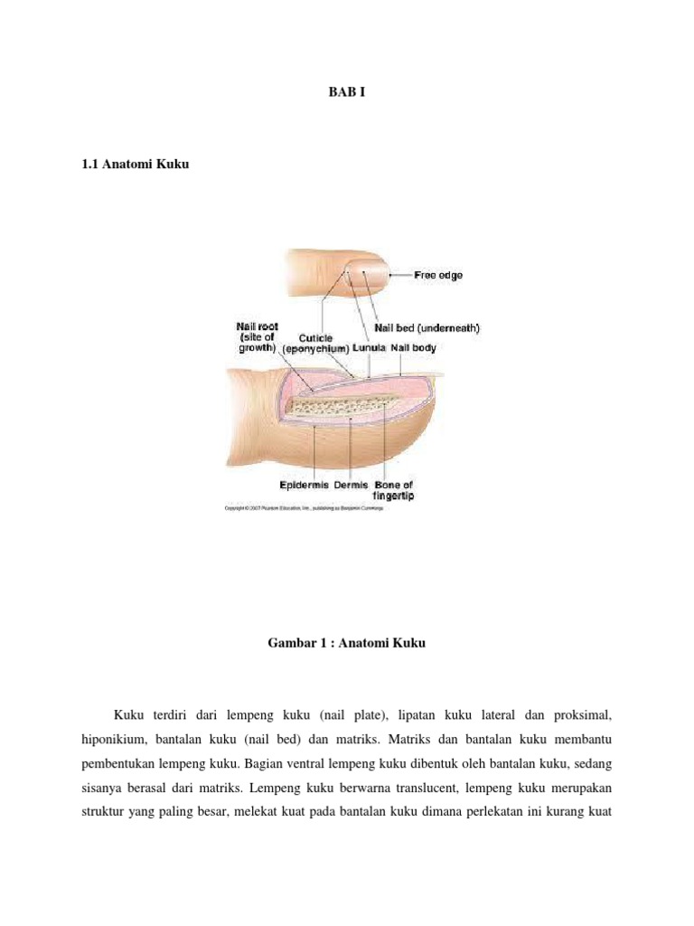 Teknik Rozerplasty Kuku dan Komplikasinya | PDF