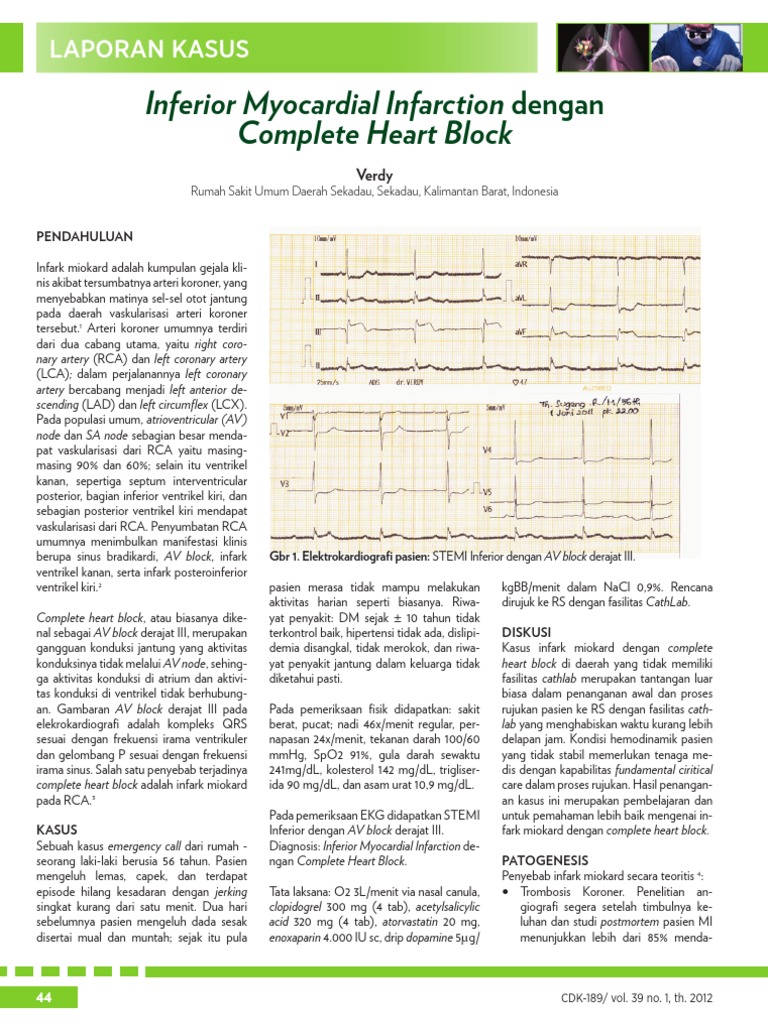 13 - 189inferior Myocardial Infarction Dengan Complete Heart Block PDF ...