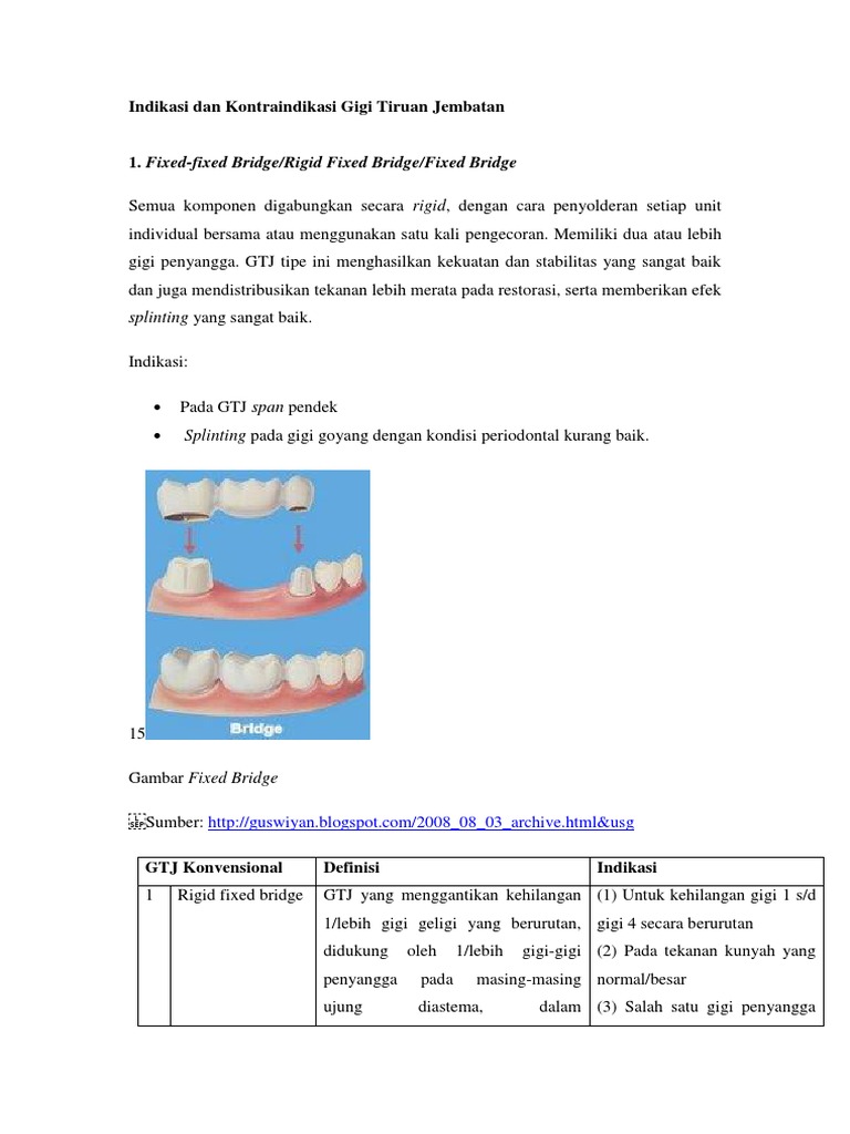 SK4 Indikasi Dan Kontraindikasi Gigi Tiruan Jembatan | PDF