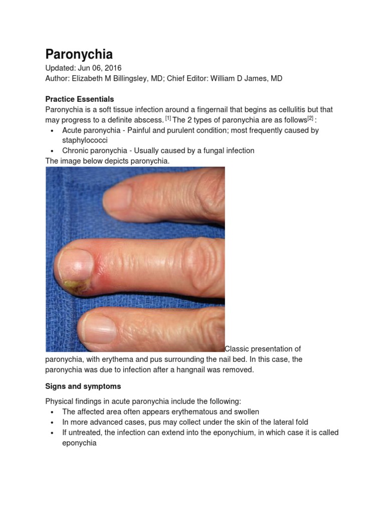 Nail Paronychia | Nail (Anatomy) | Wound