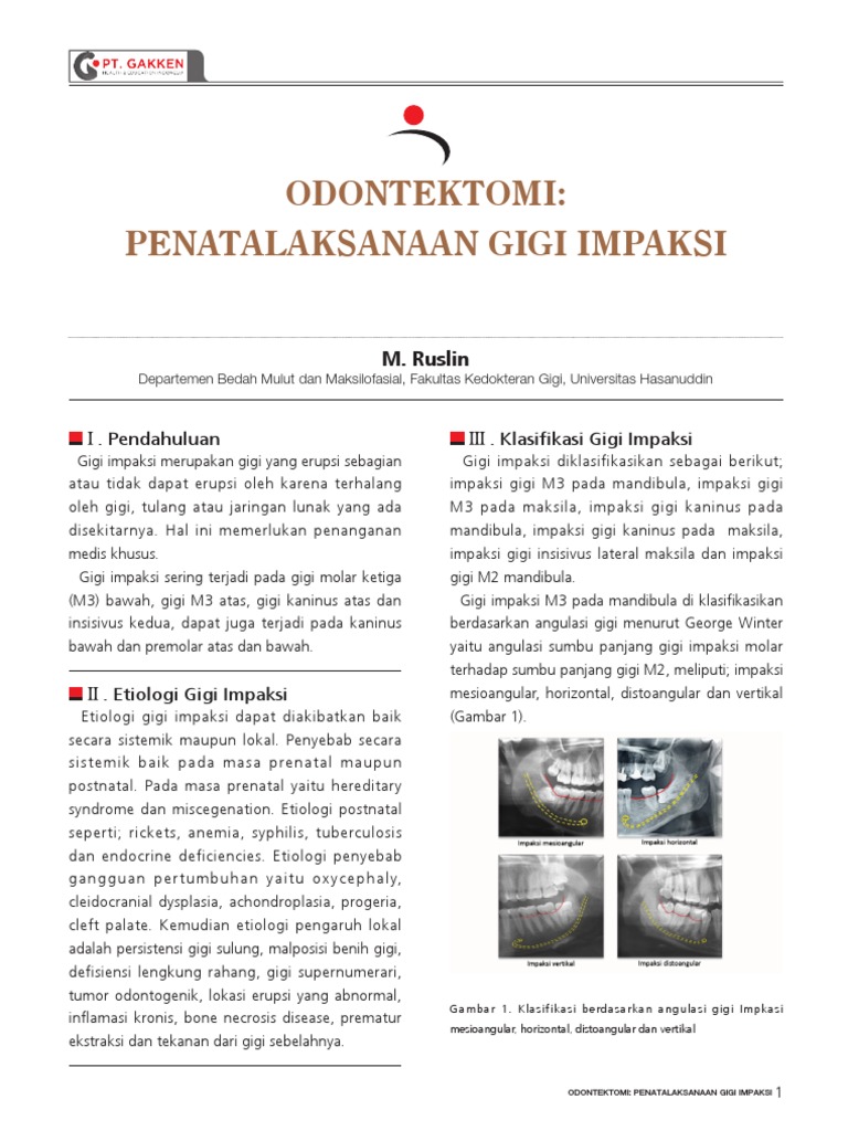Odontektomi Penatalaksanaan Gigi Impaksi Summary | PDF
