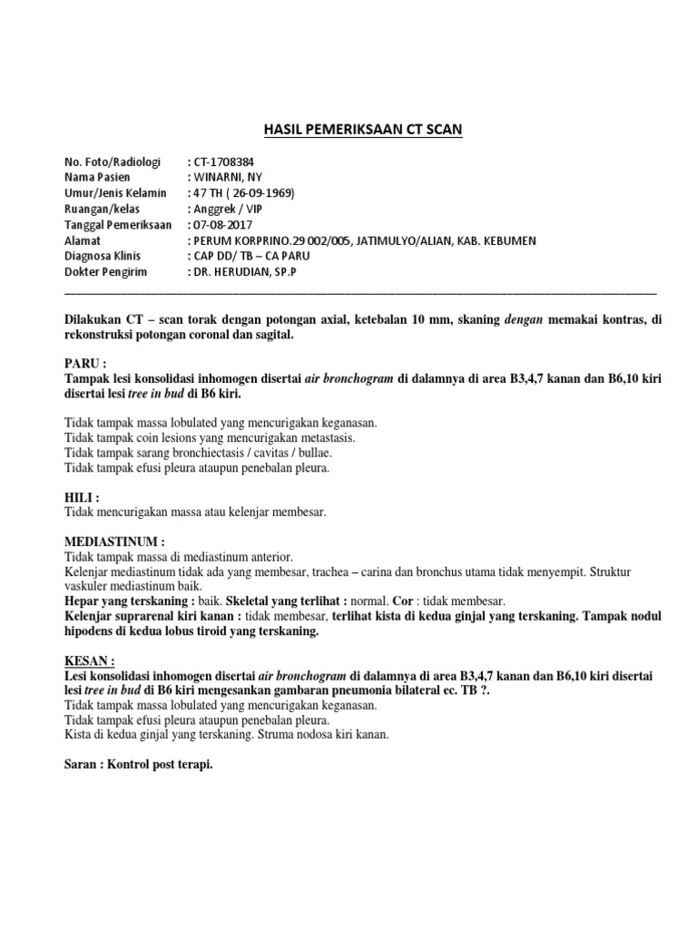 Hasil Pemeriksaan CT Scan | PDF