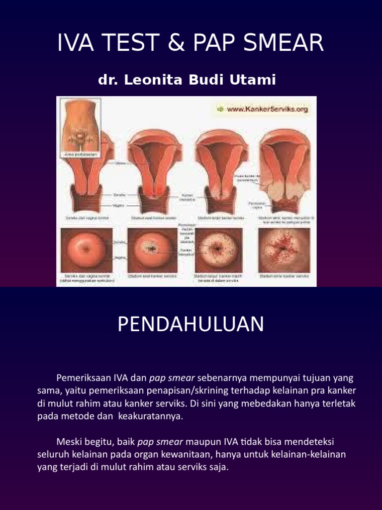 Skrining Kanker Serviks: IVA dan Pap Smear | PDF