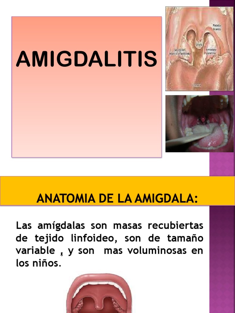 Amigdalitis: Causas y Tratamientos | PDF | Ciencia y matemáticas