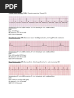 Basic Arrhythmia Rules | PDF | Electrocardiography | Physiology