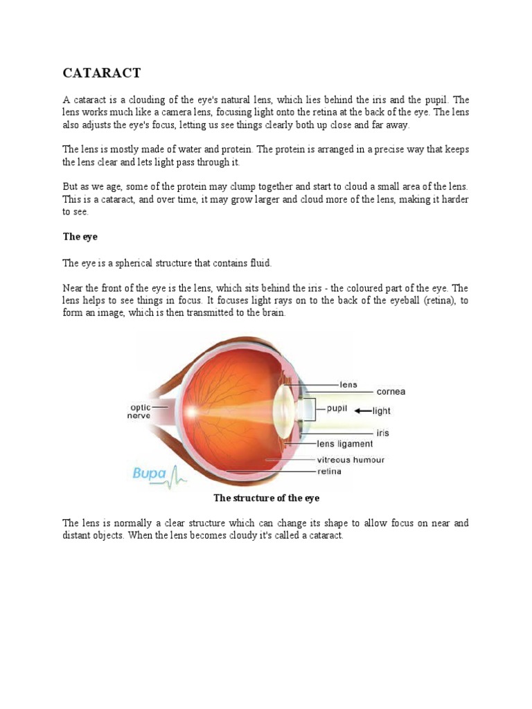 Cataract | PDF | Cataract | Eye