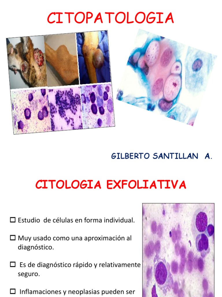 18-15 CITOLOGIA EXFOLIATIVA.ppt | Cáncer | Neoplasias
