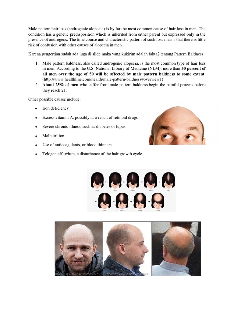 All Men Over The Age of 50 Will Be Affected by Male Pattern Baldness To ...