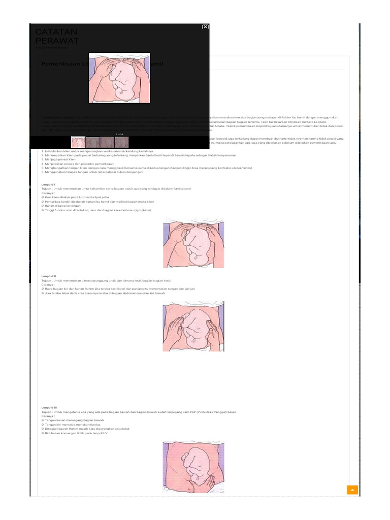 Pemeriksaan Leopold 1 4 Pada Ibu Hamil - HTML PDF | PDF