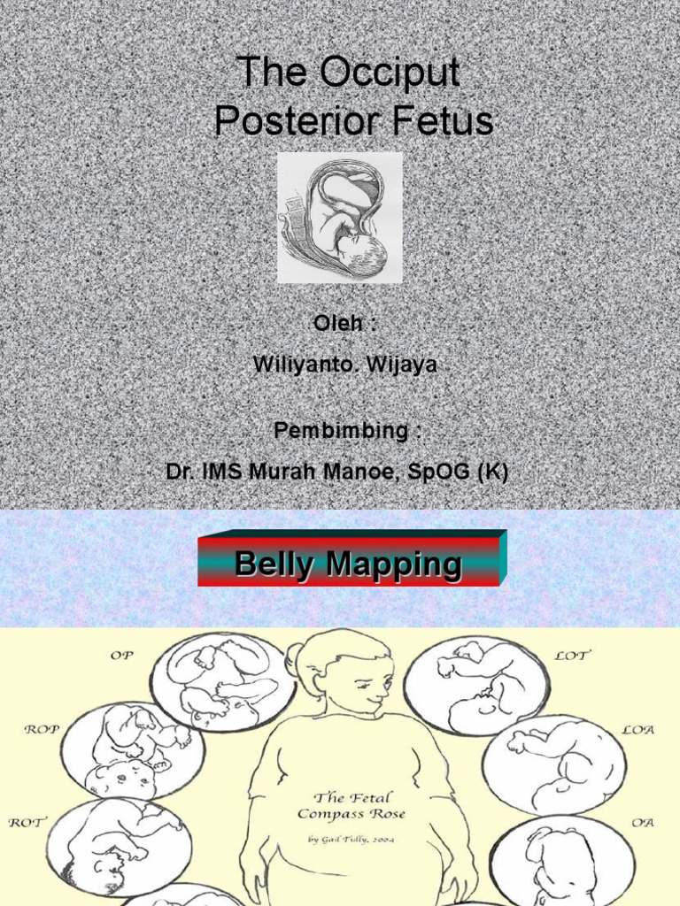 Managing Occiput Posterior Births | PDF | Uterus | Childbirth