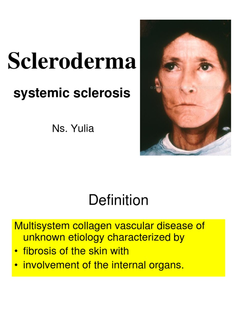 Scleroderma | PDF | Esophagus | Anatomy