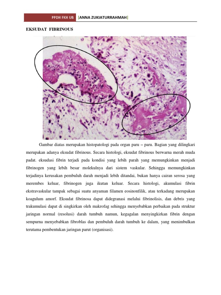 Eksudat Fibrinous | PDF