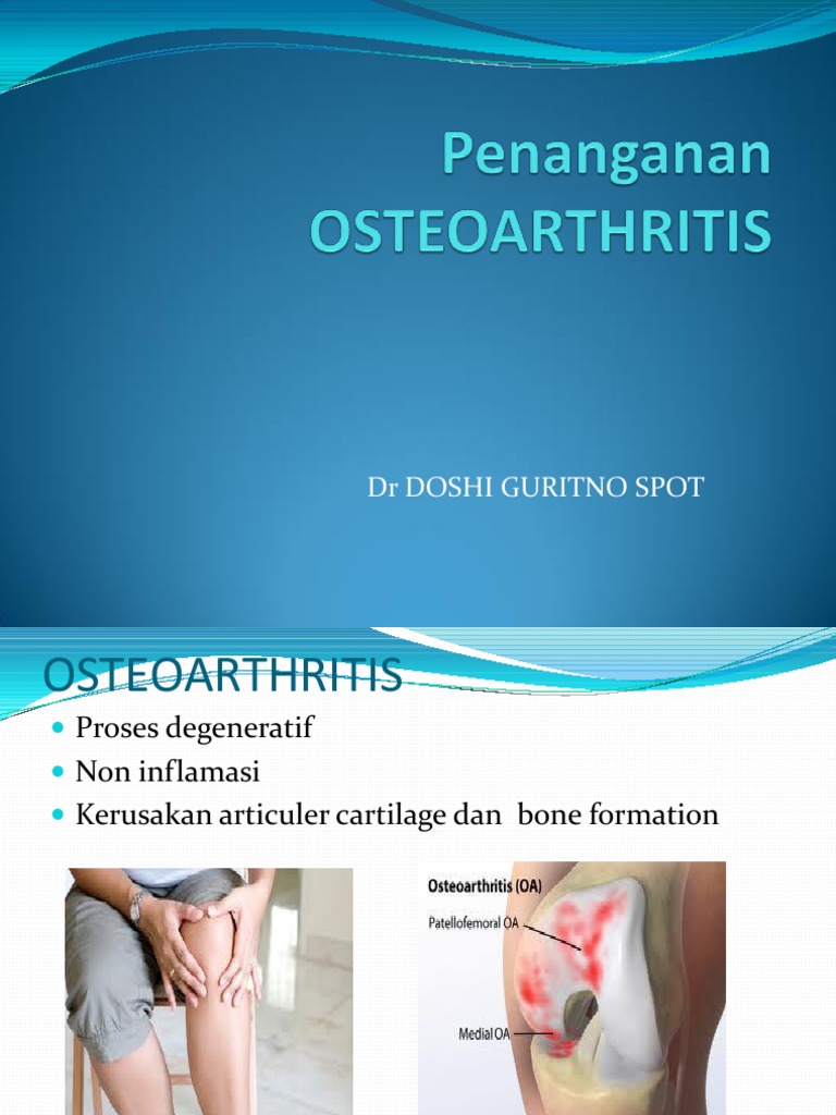 Osteoarthritis Pdf Knee Osteoarthritis